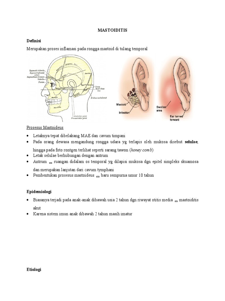 Mastoiditis | PDF