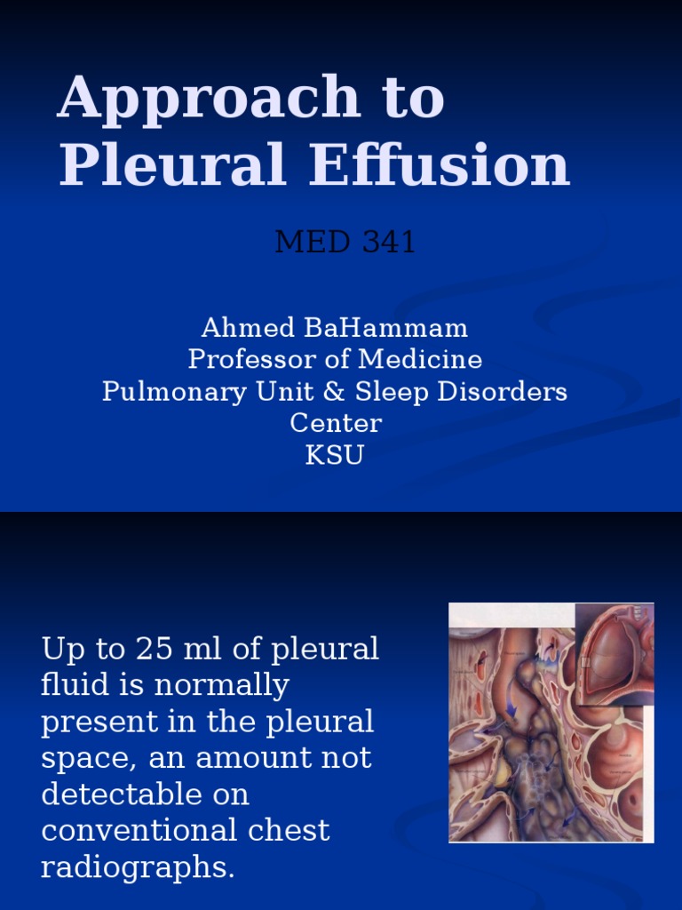 Comprehensive Guide to Pleural Effusion | PDF | Pulmonology ...