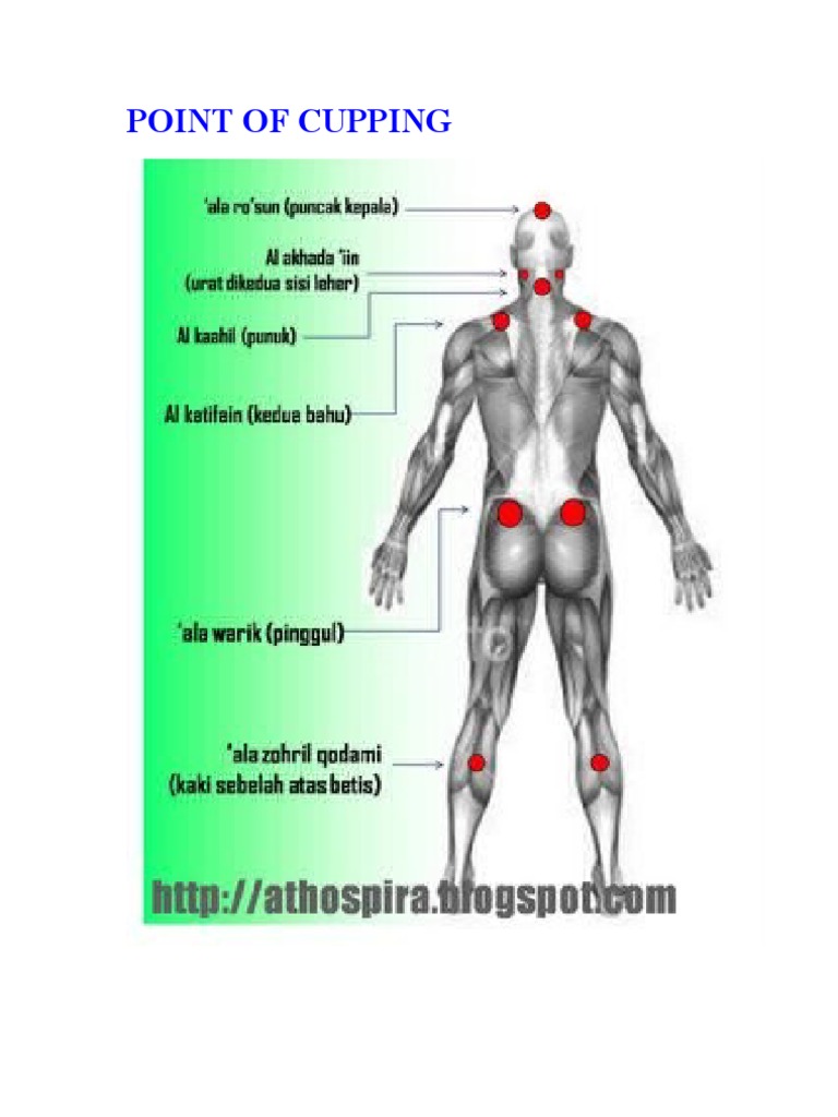Point of Cupping | PDF