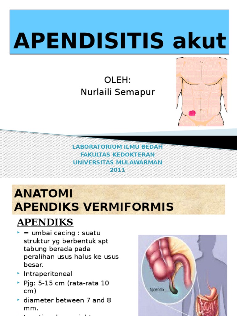 APENDISITIS Akut | PDF