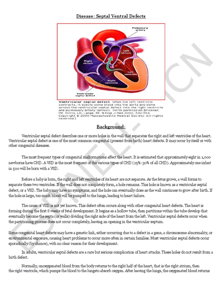 Understanding Ventricular Septal Defects | PDF | Congenital Heart ...