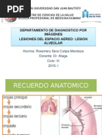 Ejemplo RX Torax Normal | PDF