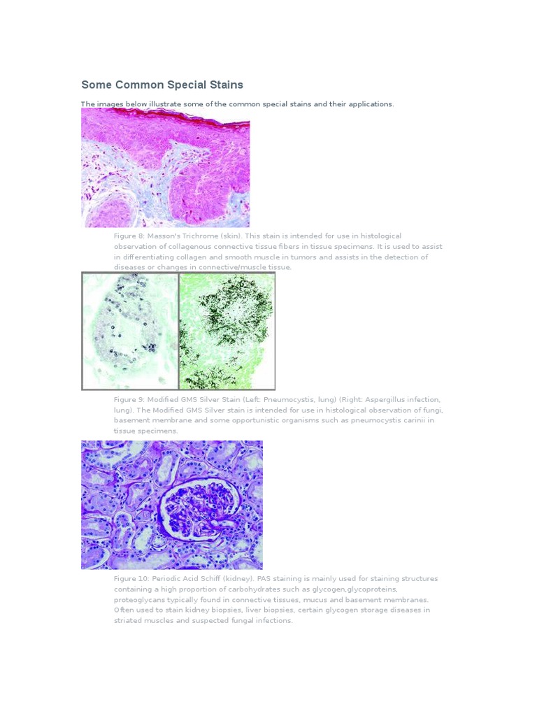 Some Common Special Stains | PDF | Staining | Muscle