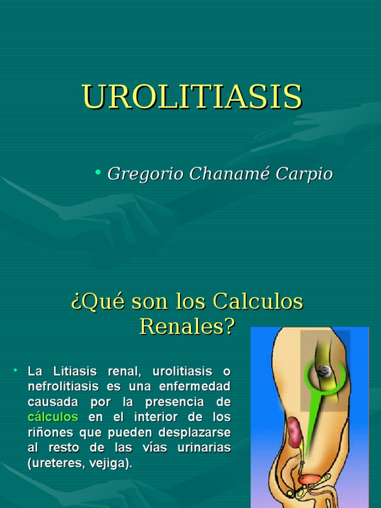 UROLITIASIS | Orina | Especialidades Medicas