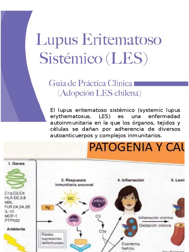 Lupus | PDF | Lupus eritematoso sistémico | Especialidades Medicas