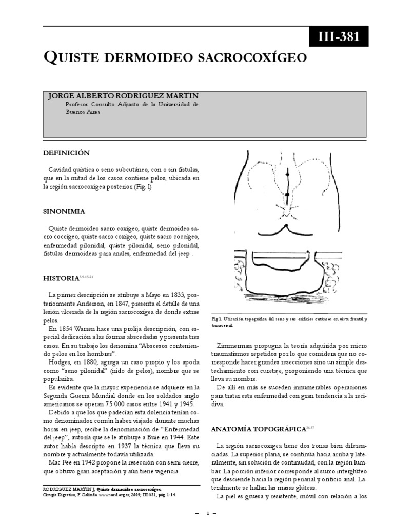 Quiste Pilonidal | PDF | Pecho | Cicatrización de la herida