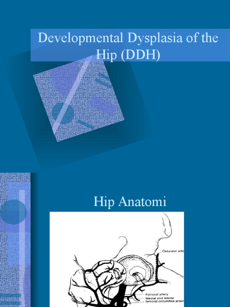 Developmental Dysplasia of The Hip (DDH) | PDF | Human Anatomy ...
