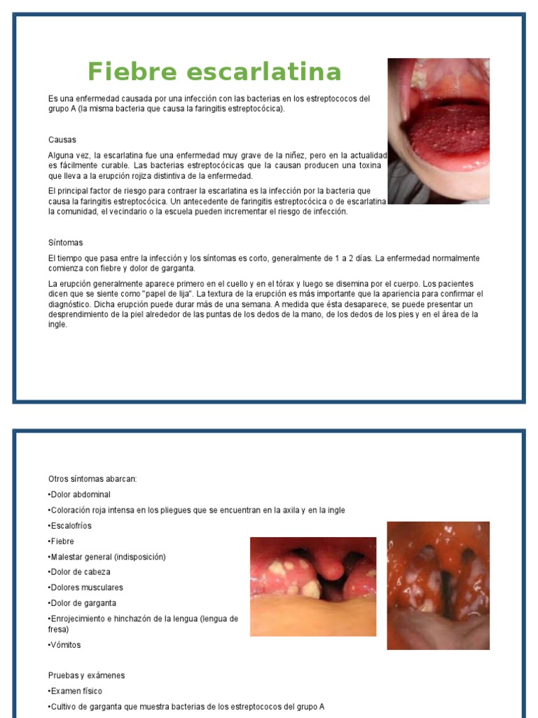 2 Fiebre Escarlatina | PDF | Epidemiología | Ciencias de la Salud