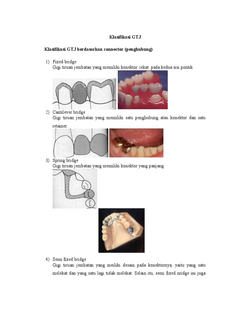 Klasifikasi GTJ | PDF
