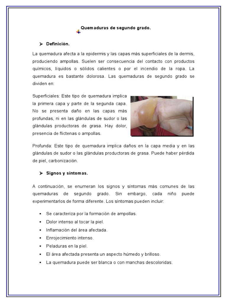 Quemaduras de Segundo Grado | Quemar | Herida