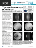 NS Grading of Cataract | PDF