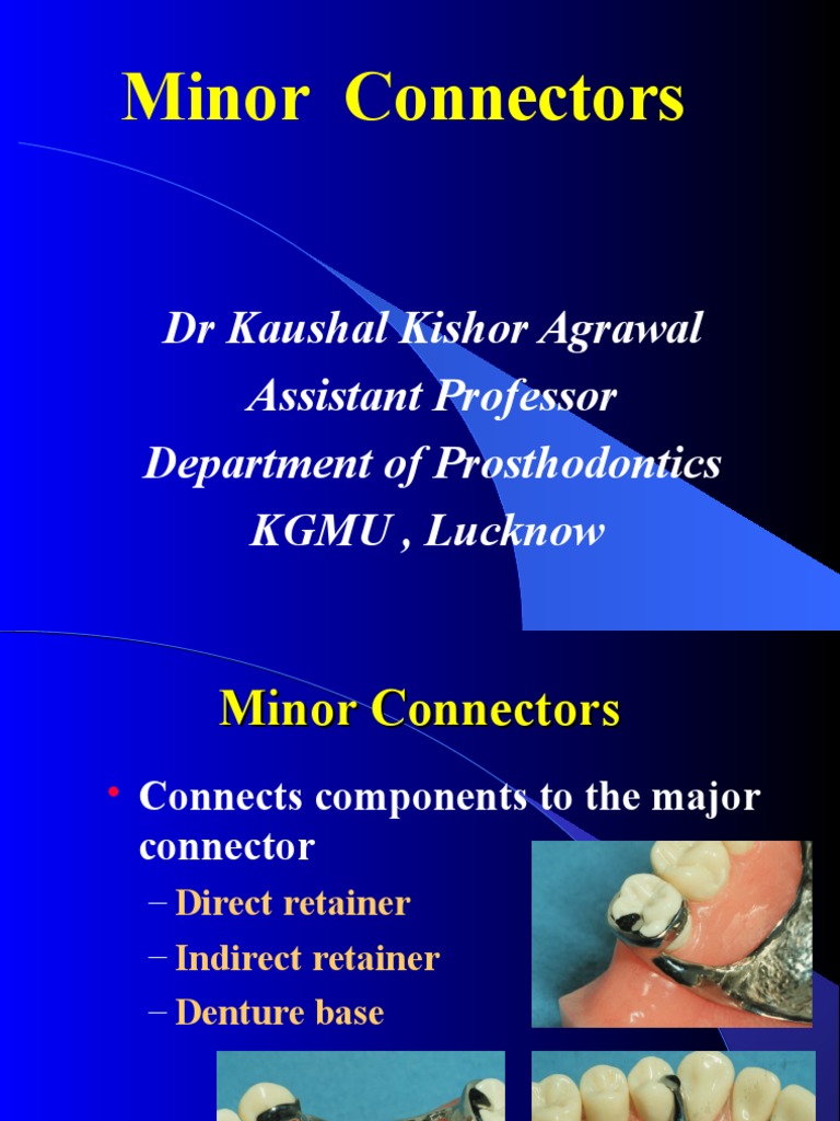 Minor Connectors | PDF | Dentures | Dentistry Branches