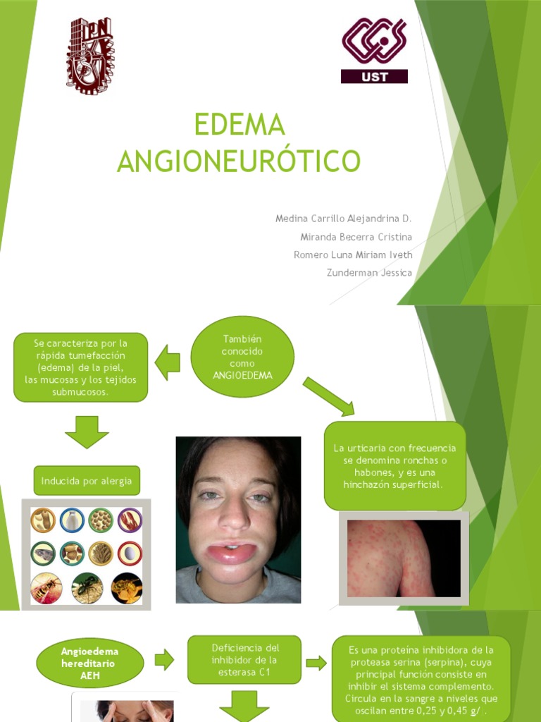 Edema Angioneurótico | PDF | Especialidades Medicas | Medicina CLINICA