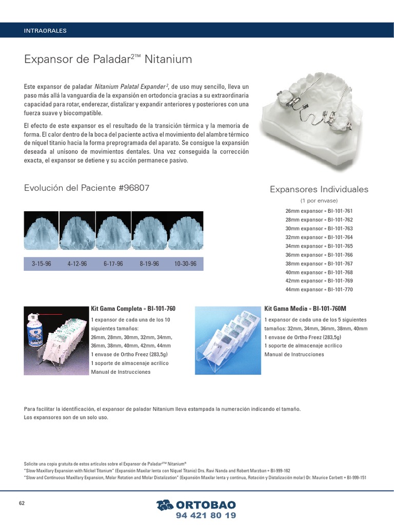 Expansor de Paladar Nitanium: Innovación Ortodóntica | PDF