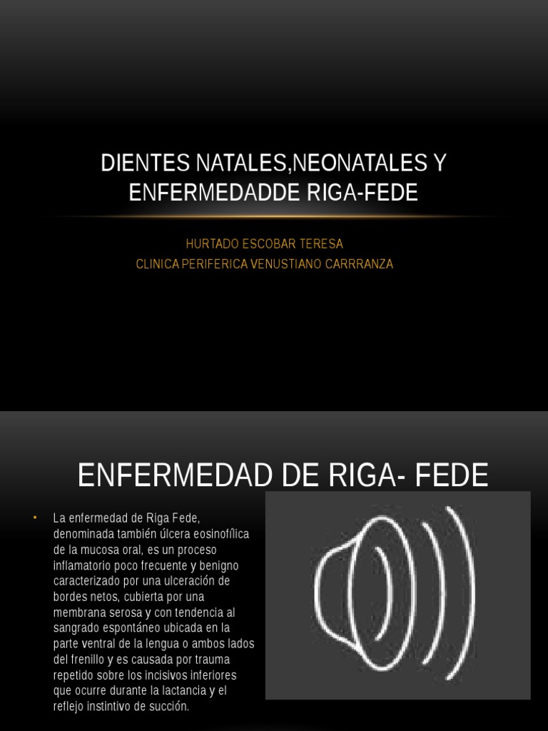 Enfermedad de Riga-Fede | Descargar gratis PDF | Diente humano ...