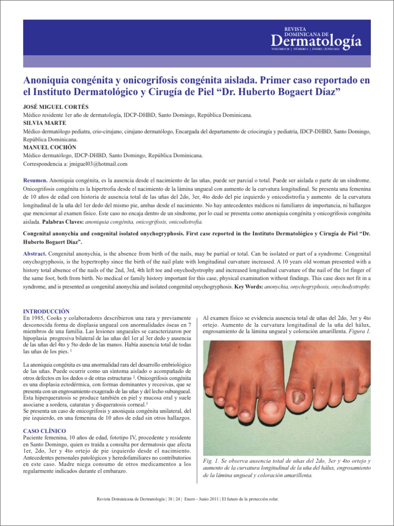 Anoniquia: Tipos y Características | PDF | Clavo (anatomía) | Sistema ...