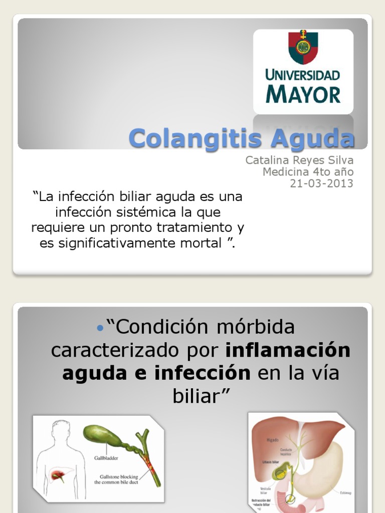 Colangitis Aguda | PDF | Enfermedades digestivas | Sistema digestivo