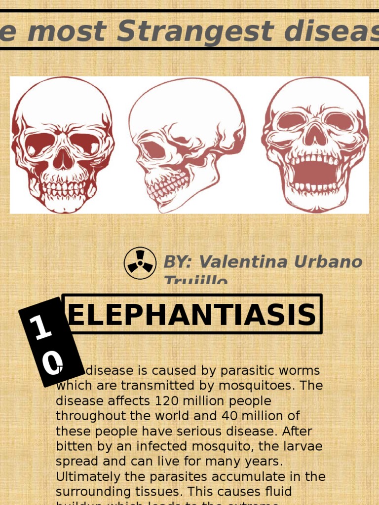 The Most Strangest Diseases | PDF | Epidemiology | Medicine