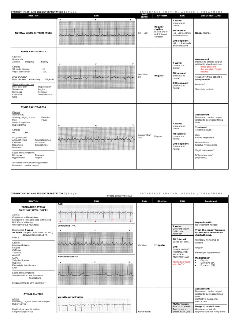 Dysrhythmias Chart | PDF | Cardiac Arrhythmia | Heart