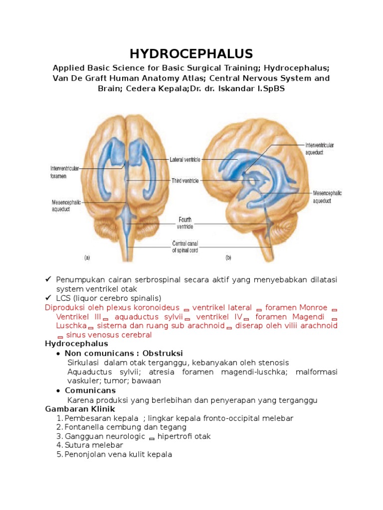 Pemahaman Hidrosefalus dan Penanganannya | PDF