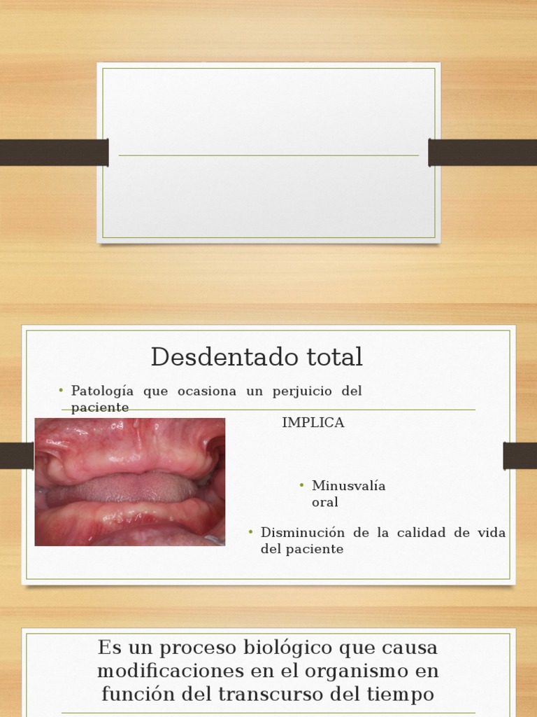 Anatomia y Fisiologia Del Paciente Desdentado | Hueso | Dentadura postiza