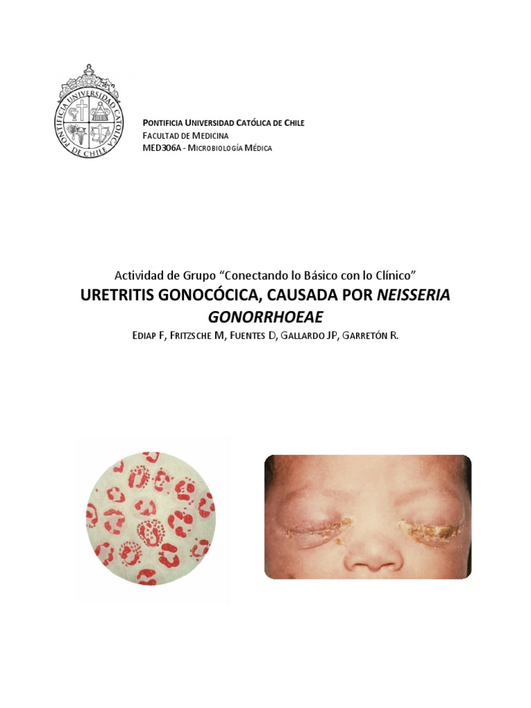 Uretritis Gonocócica Por N. Gonorrhoeae | Enfermedades y trastornos ...