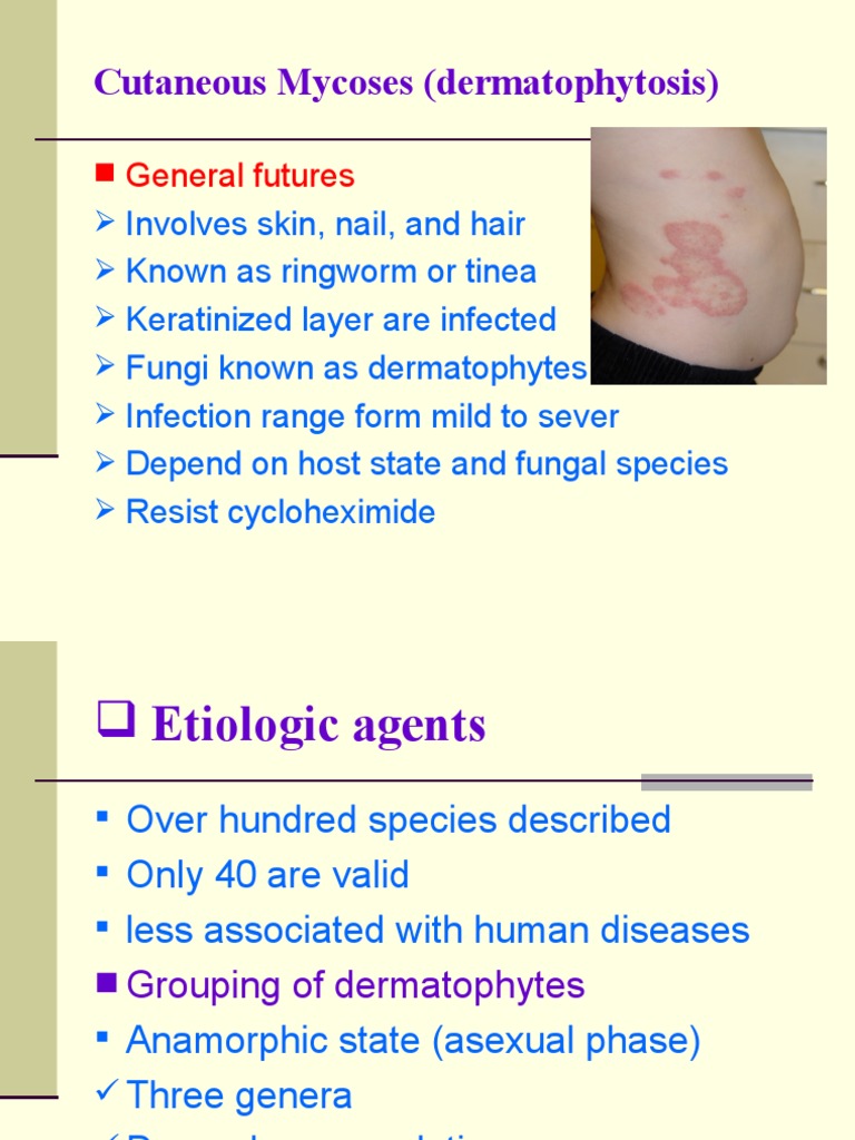 Overview of Cutaneous Mycoses | PDF | Microbiology | Mycology