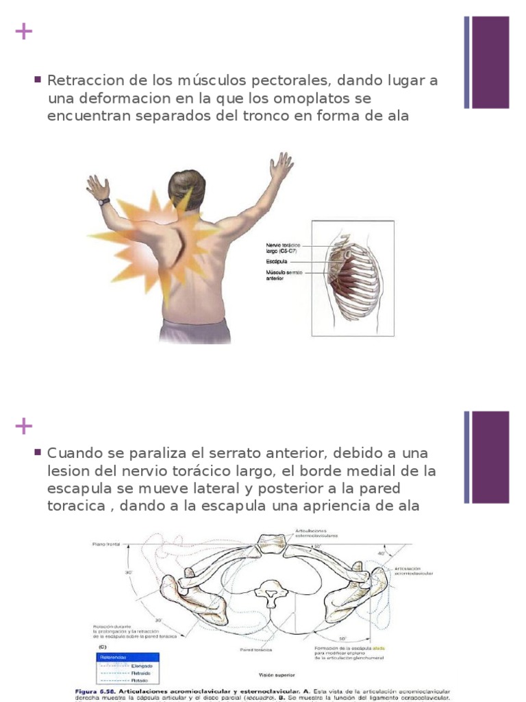 Escapula Alada | PDF | Ciencia de la danza | Anatomía humana