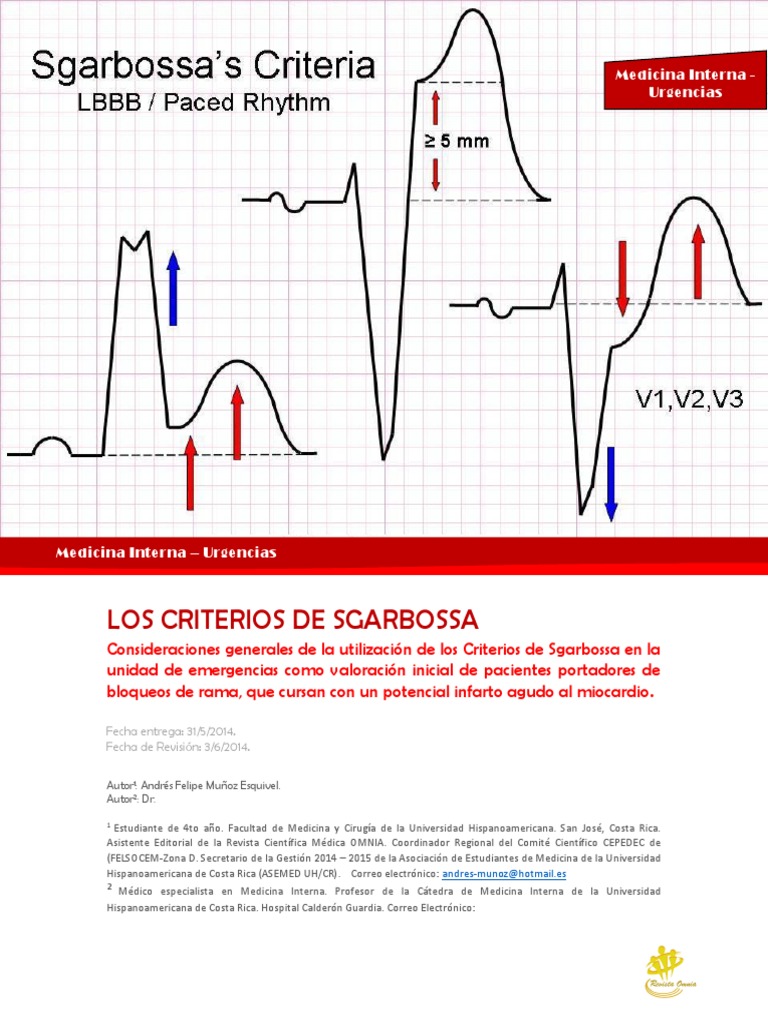 Sgarbossa criterios | Electrofisiología cardíaca | Electrocardiografía