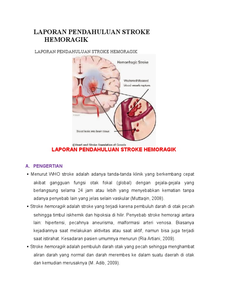 Stroke Hemoragik | PDF