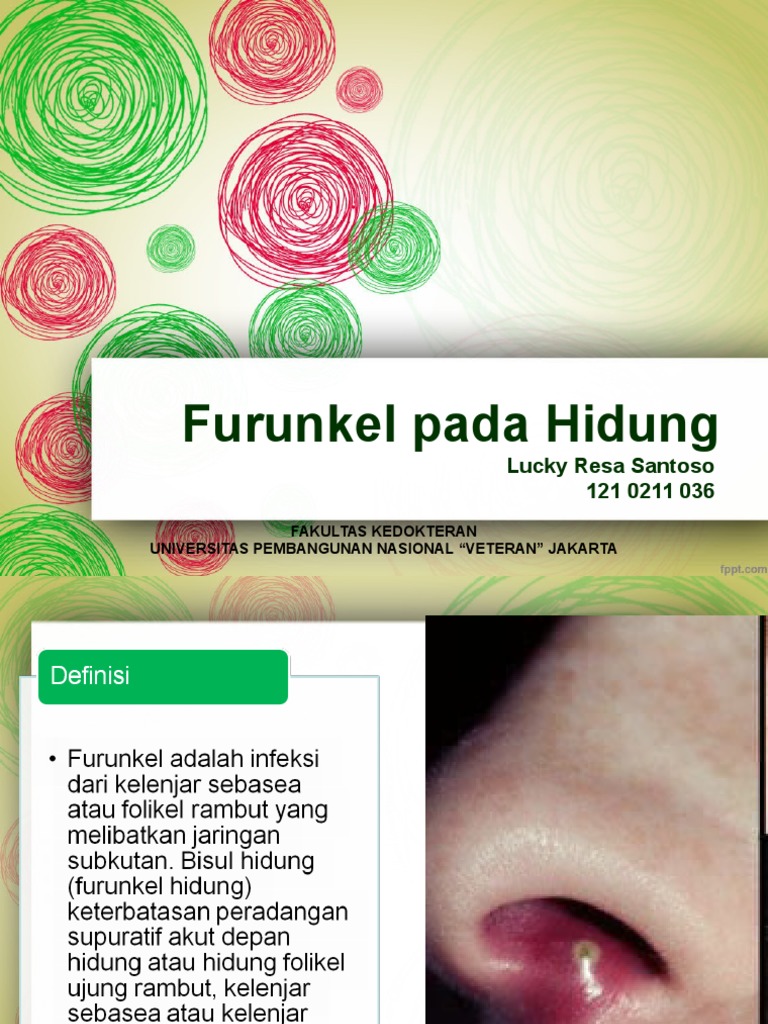 SSS - Furunkel Pada Hidung | PDF
