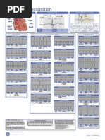Basic EKG Interpretation Exam Answers | PDF | Electrocardiography ...