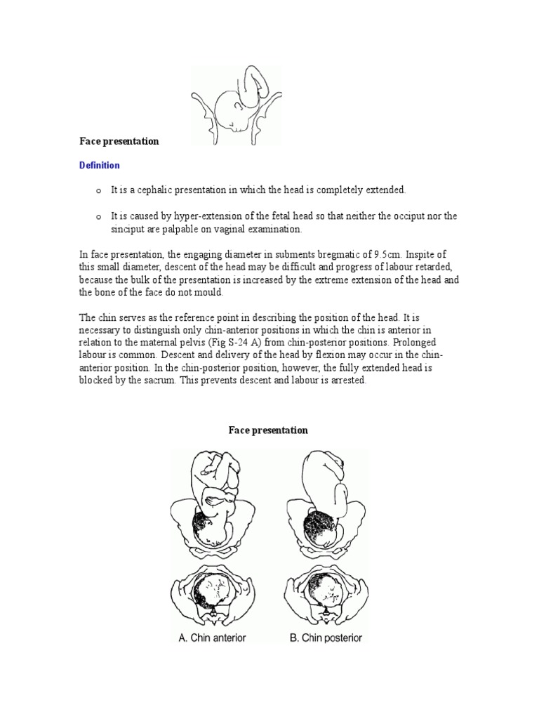 Face Presentation Mentum Posterior