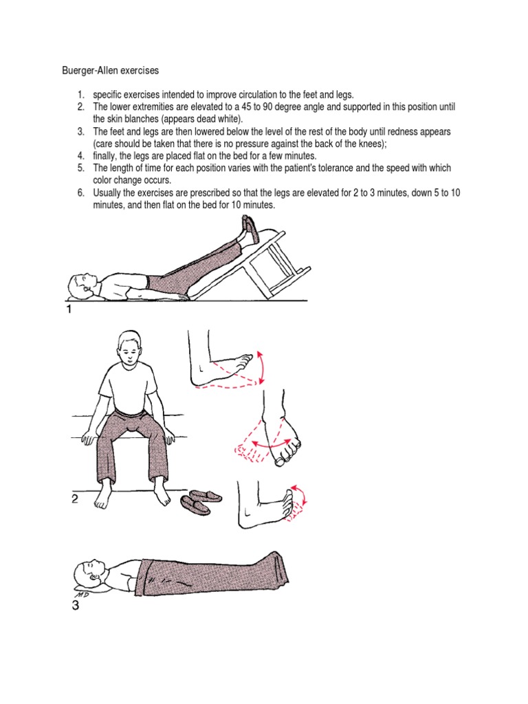 Buerger-Allen Exercise Steps | PDF | Wellness