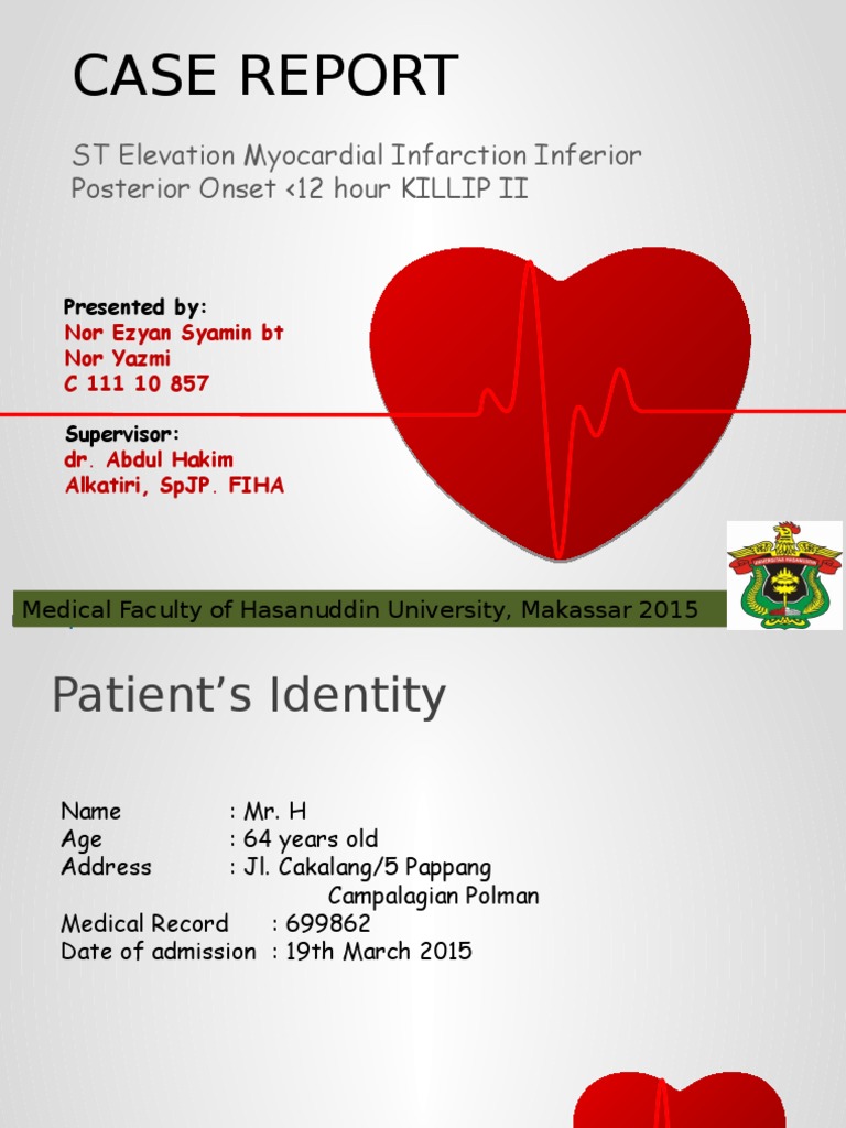 Case Report STEMI Inferior Posterior | PDF | Myocardial Infarction | Heart