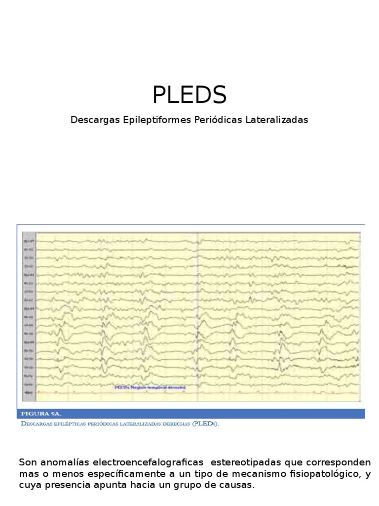 PLEDS: Descargas Epileptiformes Periódicas | PDF | Ritmo | Olas