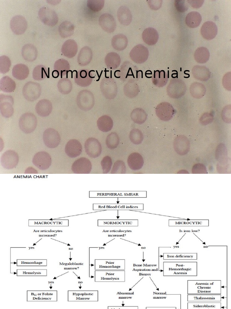 Normocytic Anemia's | PDF | Anemia | Medical Specialties