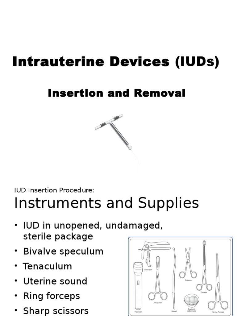 Intrauterine Devices (Iuds) : Insertion and Removal | PDF | Uterus ...
