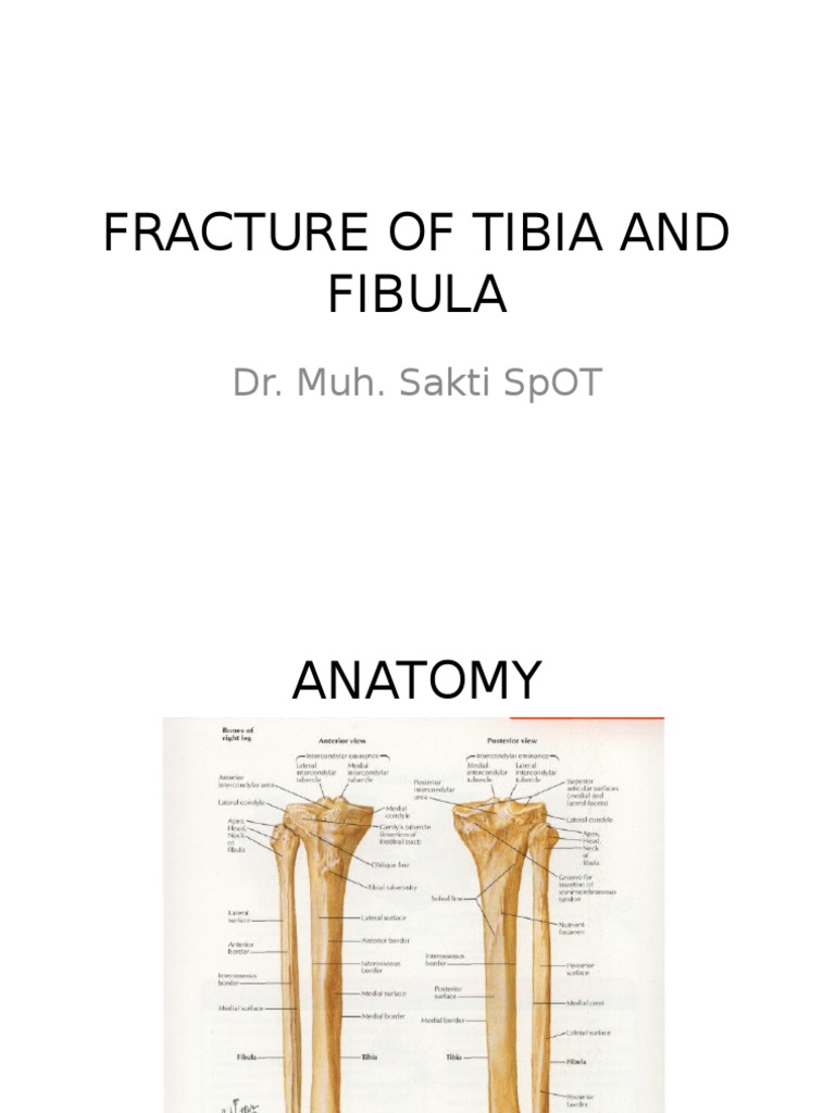 Fracture of Tibia and Fibula | PDF