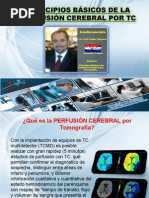 Escala ASPECTS | PDF