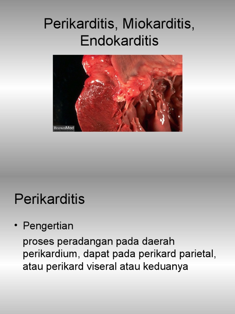 Perikarditis, Miokarditis, Endokarditis | PDF