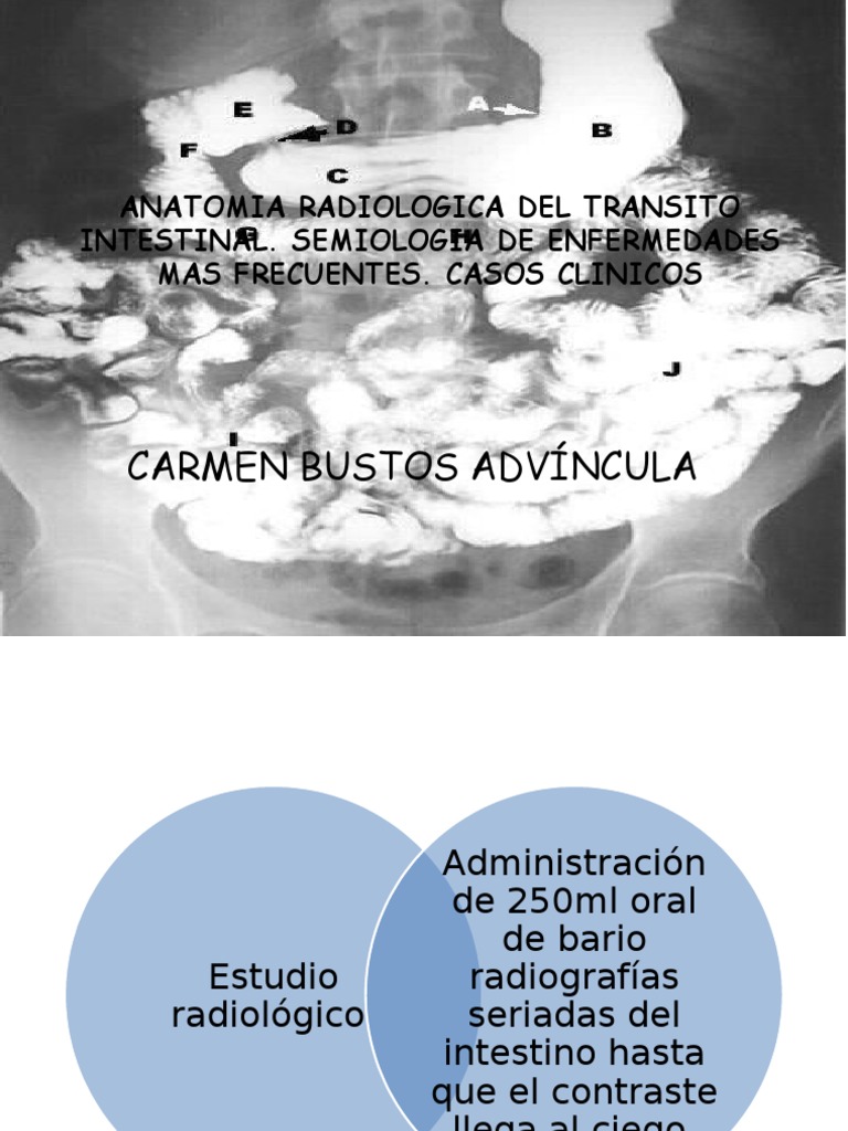 Anatomia Radiologica Del Transito Intestinal