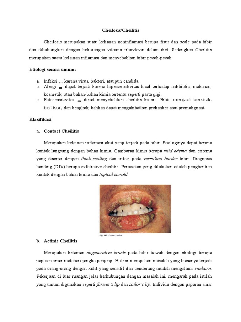 Cheilosis Dan Cheilitis | PDF | Sains & Matematika