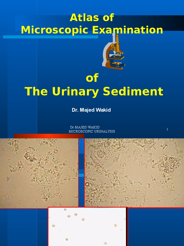 Atlas Urinalysis | PDF