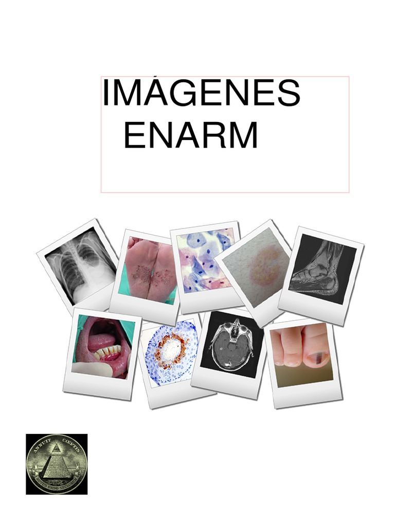 Imagenes Enarm ID | PDF | Traumatologia | Cirugía Ortopédica