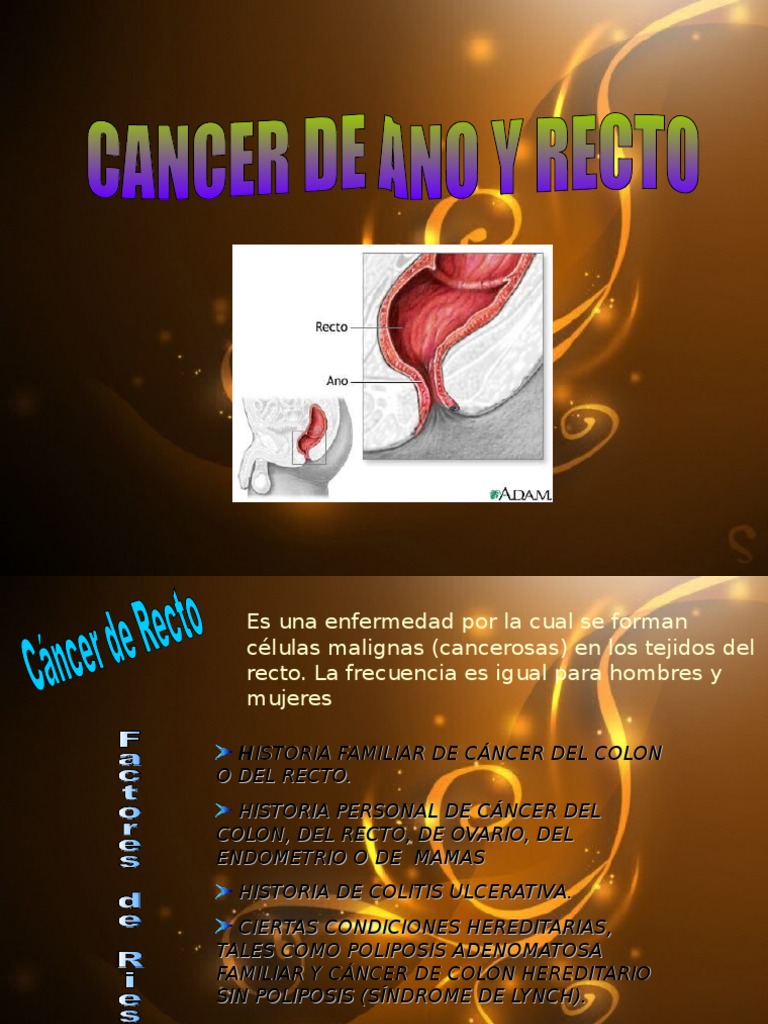 Factores de riesgo, síntomas, diagnóstico y estadificación del cáncer ...