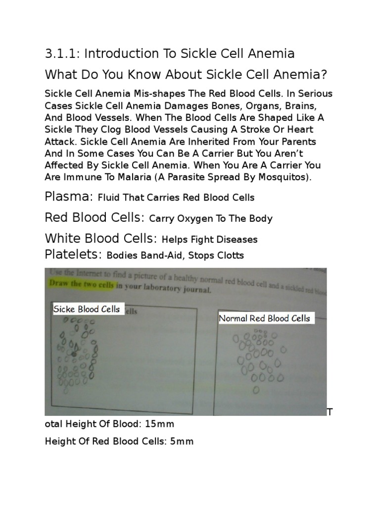 Sickle Cells | PDF