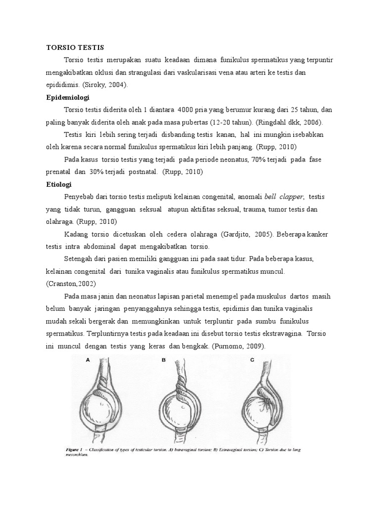 Torsio Testis | PDF