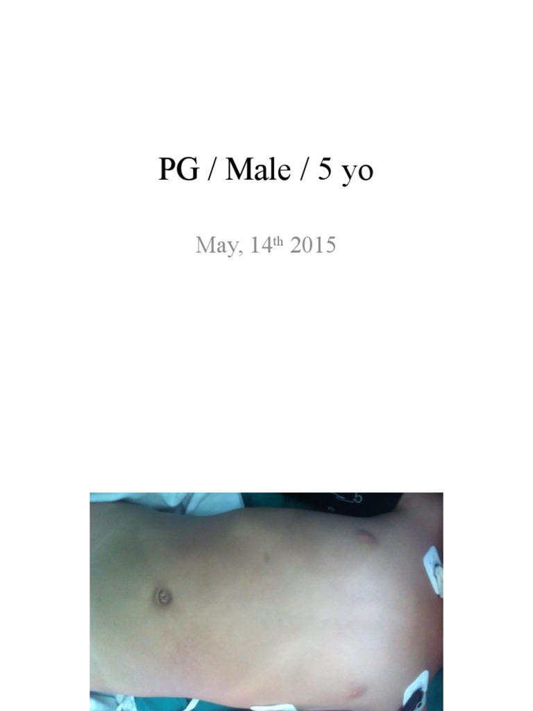 Pediatric Acute Appendicitis Case Study | PDF
