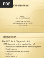 Understanding Delta Waves in ECG | PDF | Medical Specialties | Causes ...